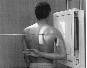 Tecnicas Radiológicas 2011: Escàpula Proyeccion Lateral posicion del ...