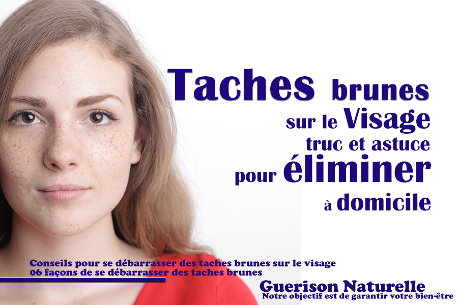 Emillyapos: Taches brunes sur le Visage: truc et astuce pour éliminer
