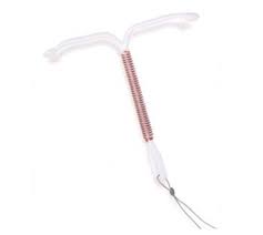 Pengalaman Pasang KB IUD Nova T 380 dan Penjelasannya