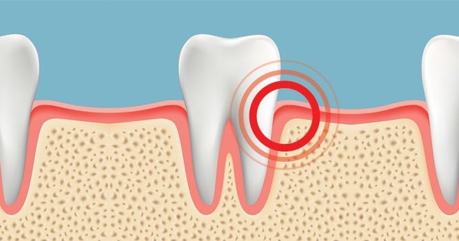 Solace Dental: Gum Pain Causes, Relief and Treatments