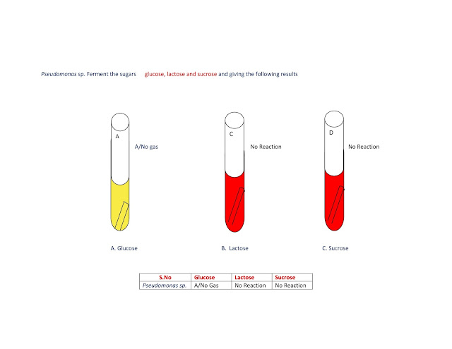 SENTHIL PRABHU SIVASAMY: Carbohydrate Fermentation Test