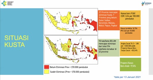 Mengenal Kusta, Penyakit Tropis yang Terabaikan di Indonesia