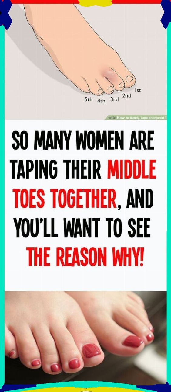 So Many Women Are Taping Their Middle Toes Together, And You’ll Want To ...
