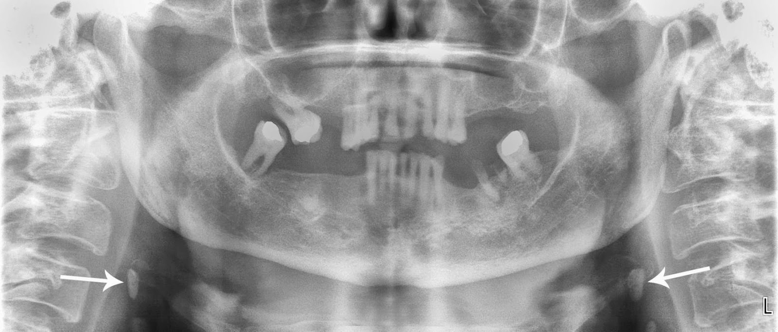 Has a dentist ever checked your blood pressure?