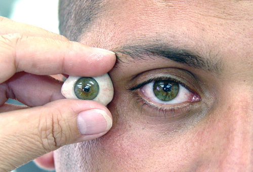 ¿Por qué se usa una prótesis de ojo?