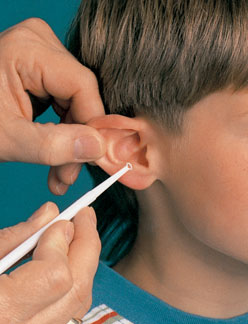 AmericanMedicals: Safe Ear Curettes™ from Bionix Medical Technologies