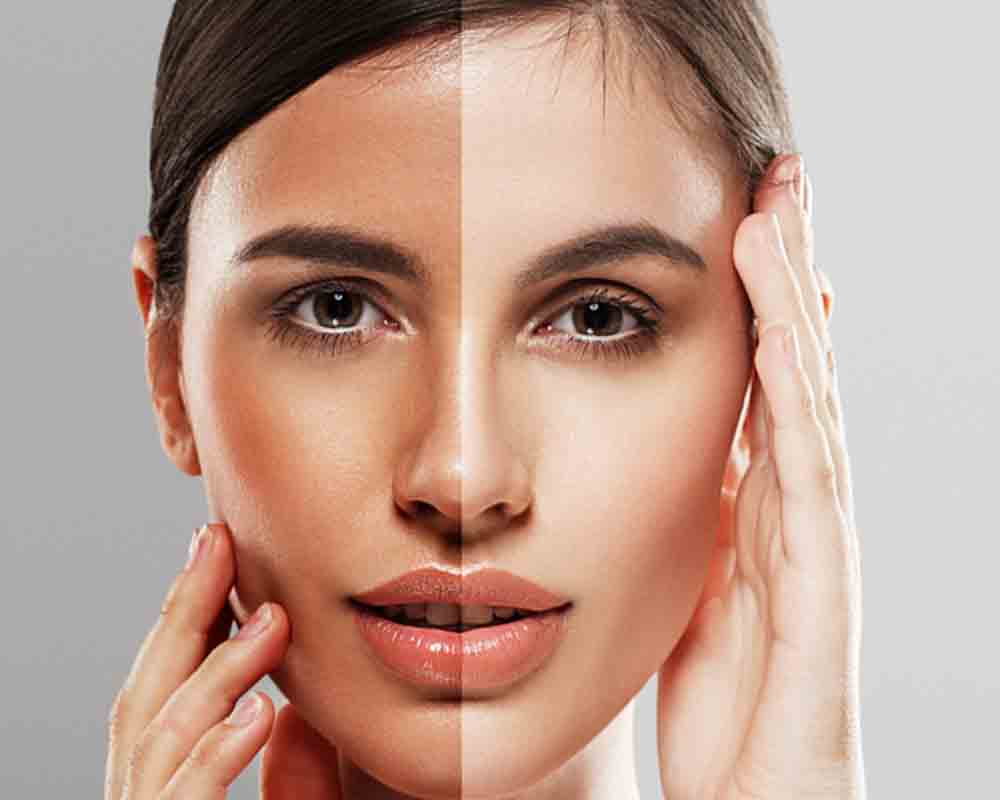 How to Remove Tan from Face Naturally | Skin Tanning Removal Home Remedies