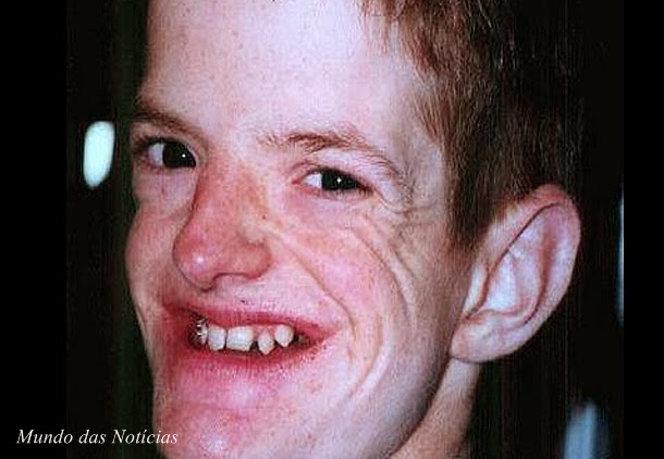 Os 10 homens mais feios do mundo: Confira! | Notícias do Dia