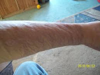 Erklärungen, Bilder, Hilferufe usw. übers ritzen!