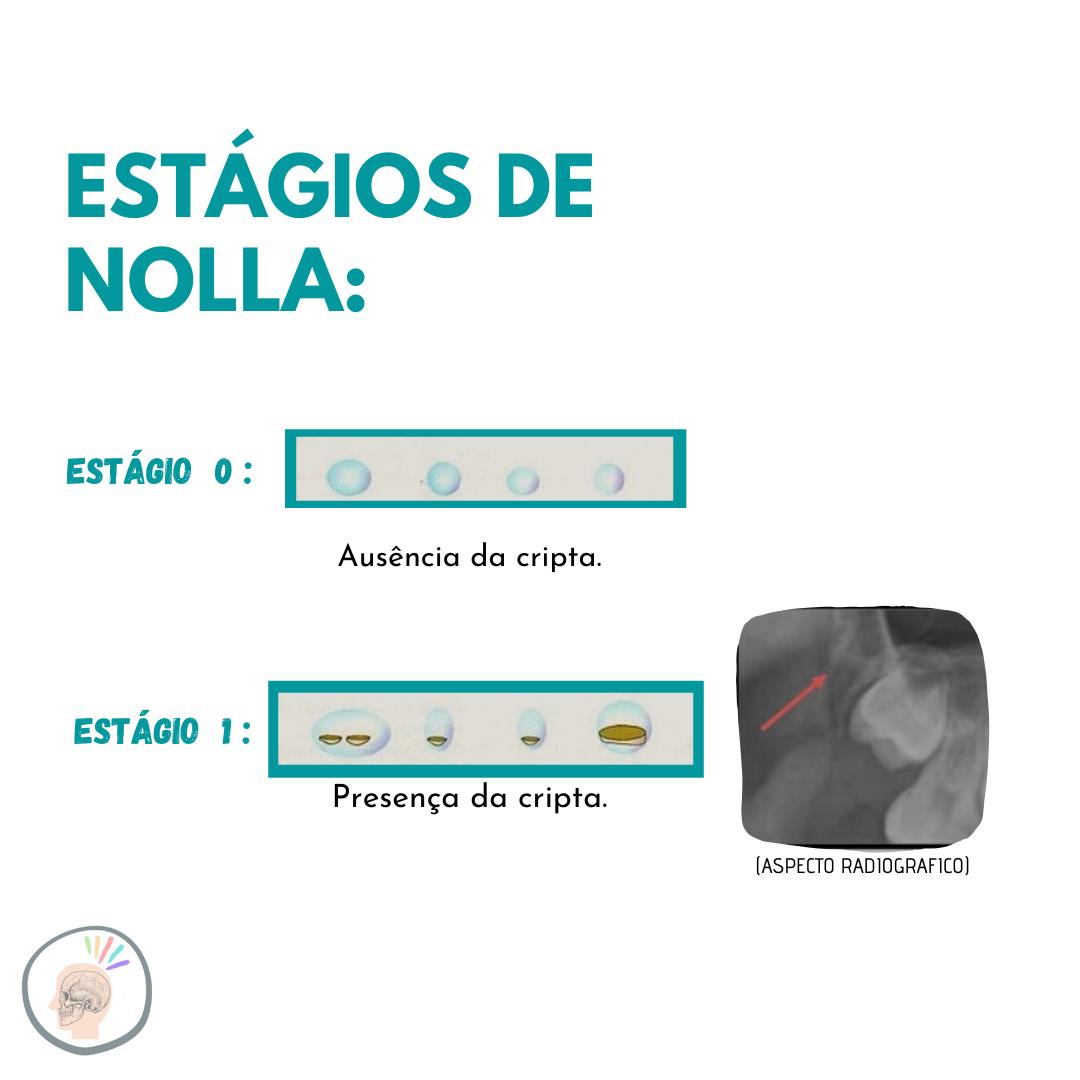 Canal da Odonto: CLASSIFICAÇÃO DE NOLLA