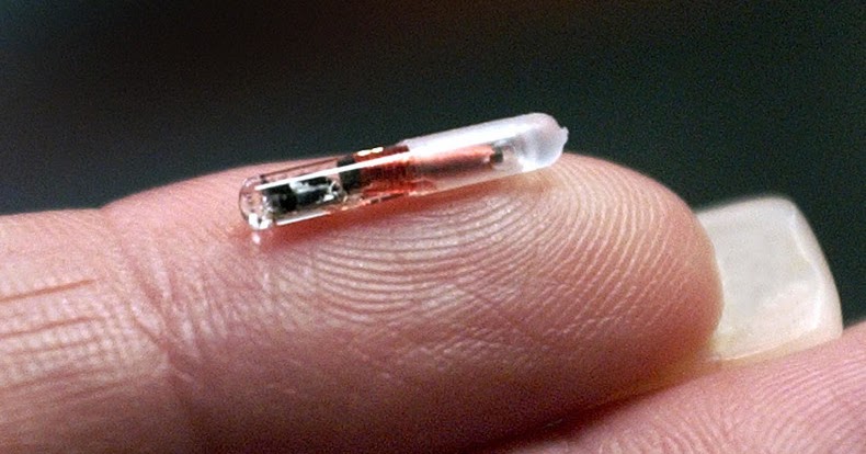 Human Microchipping, The Benefits And Downsides