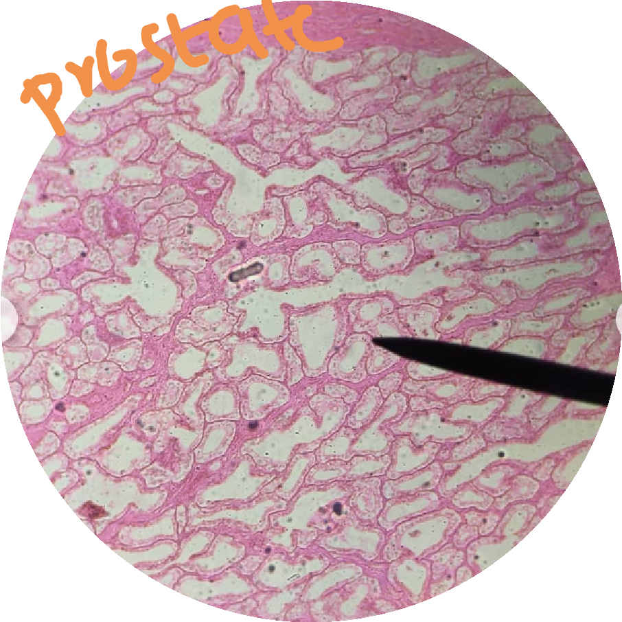 Histology of prostate, testes, epididymis & vas deferens