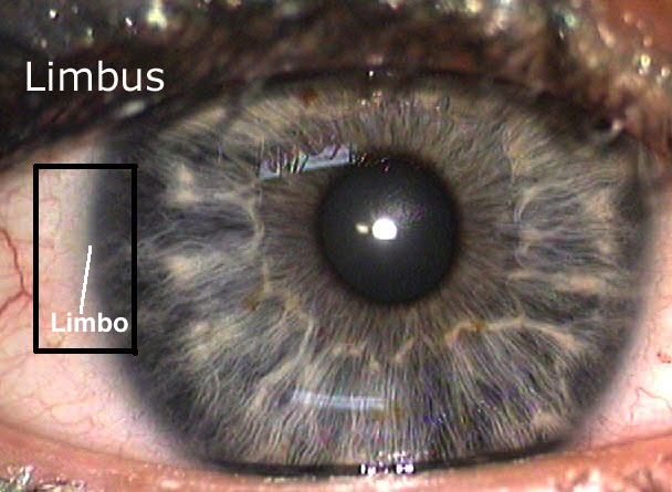 Limbo Da Córnea; Limbo Corneano; Junção Corneoescleral; Limbo ...