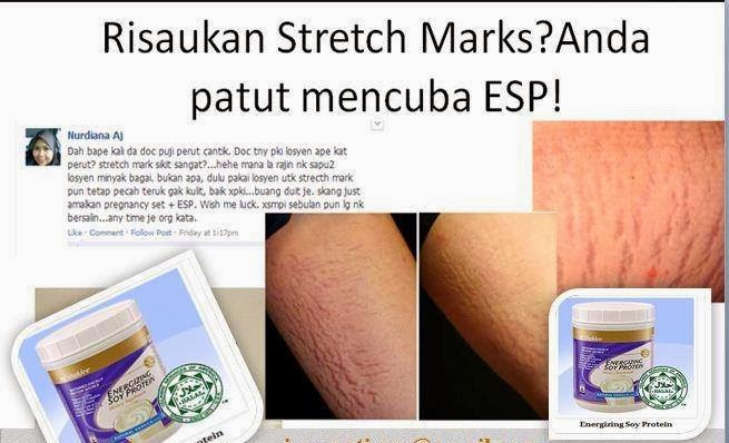 LuvHaryani: Tips Hilangkan Selulit Dengan Selamat