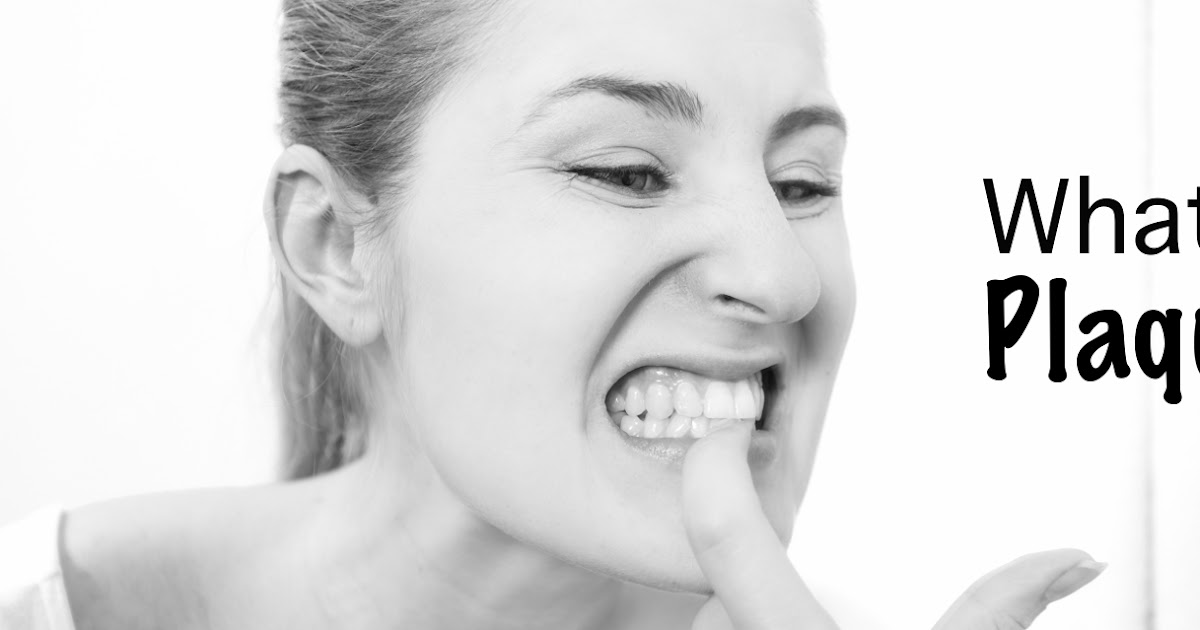 Smile Station: What is Plaque?