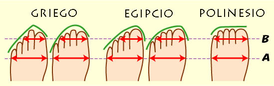 ¿Tienes los pies griegos, egipcios o polinesios?