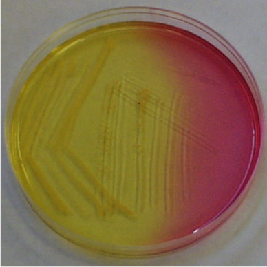 Microbiology Solutions: What is the difference between Bioburden and ...