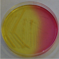 Microbiology Solutions: What is the difference between Bioburden and ...