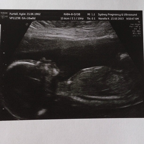 The Final Frontier. I mean Trimester!