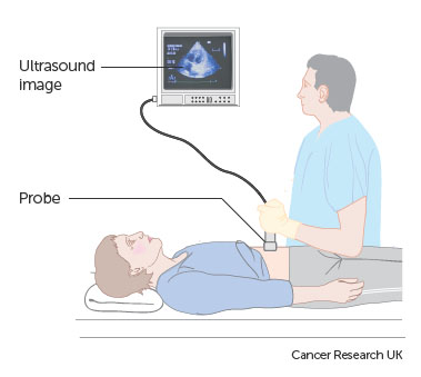 All About Ultrasound