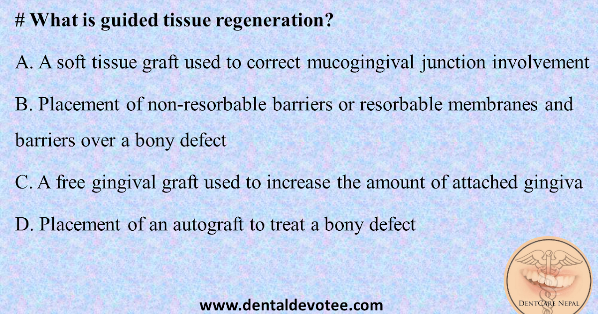 Dentosphere : World of Dentistry: GUIDED TISSUE REGENERATION