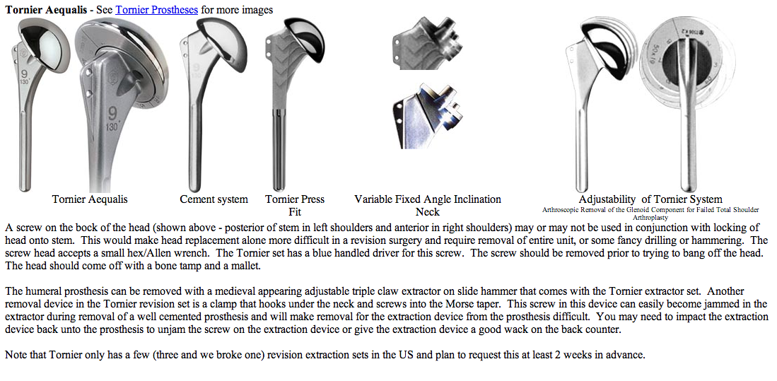 Shoulder and Elbow Surgery: Identifying the implanted shoulder ...