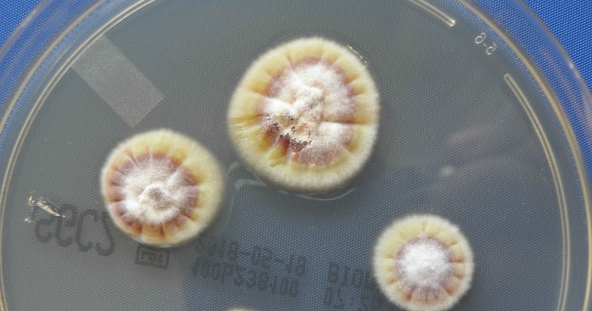 ATLAS MICOLOGIA: TRICHOPHYTON RUBRUM - COLÓNIA COM 13 DIAS DE INCUBAÇAÕ