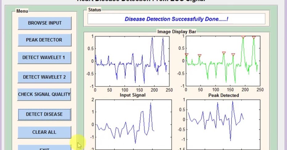 Heart Disease Detection Matlab Project With Source Code ~ Matlab Project Codes