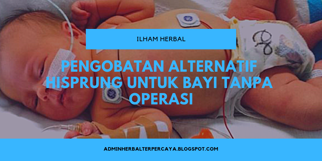 Admin Herbal Terpercaya: Pengobatan Alternatif Hisprung Untuk Bayi ...