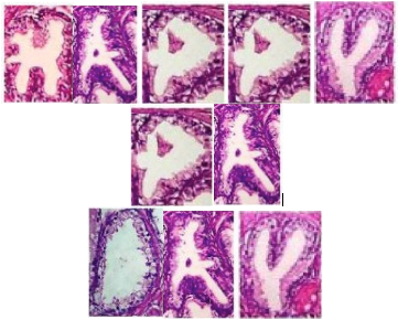 Becoming a PA: It's Pretty Gross: Happy 1st Annual Pathologists ...