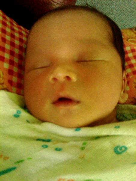 Obat Alami Untuk Mengatasi Demam Kuning (Yellow Fever) Sampai Sembuh ...