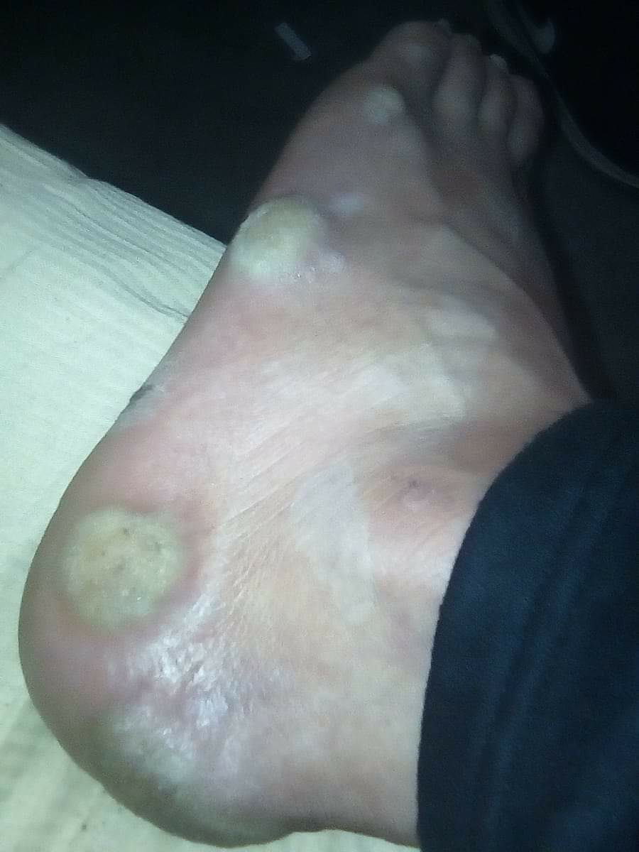 zdravniki4azilante: IN-FIELD TRAINING AND EDUCATION FOR PARAMEDICS IN ...