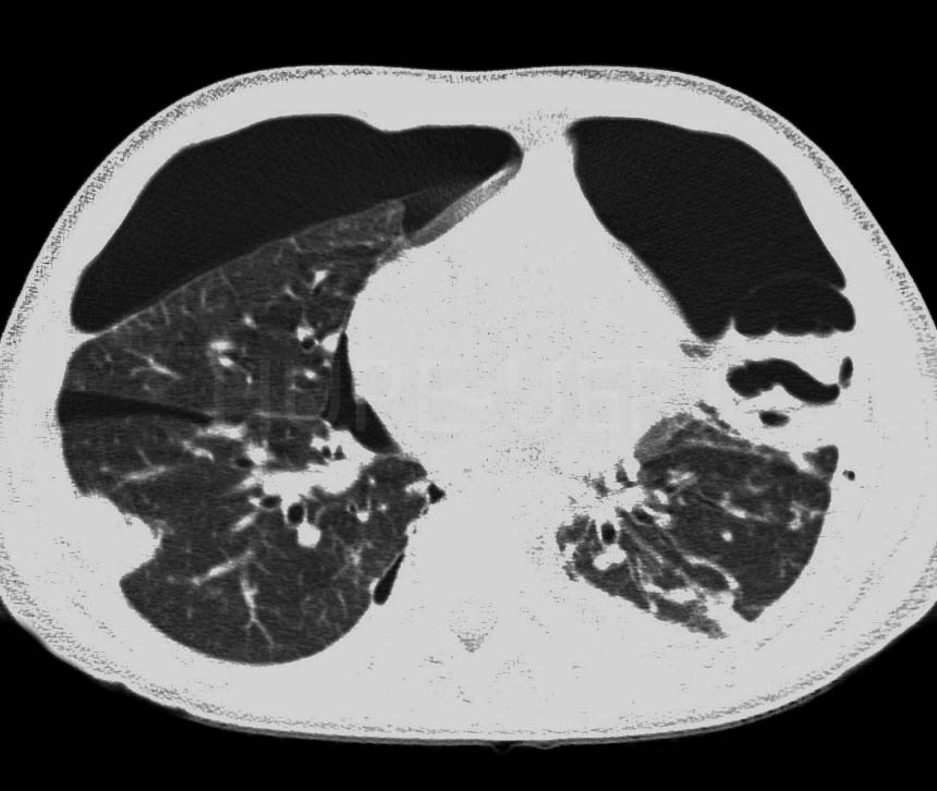 DISCIPLINA DE RADIOLOGIA DA UERJ NO FACEBOOK - Projeto de Extensão ...