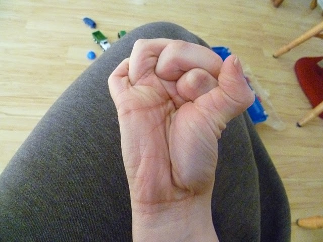 THIS I KNOW | a mommy blog about our son with special needs: Is It Genetic?