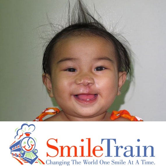 TGGS Citizenship Blog: Worth your while make a smile- help Smile Train ...