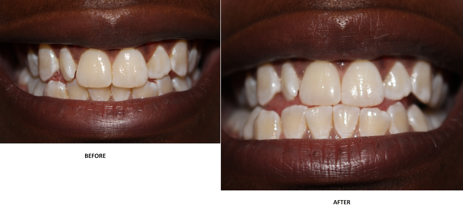 FABEAU TRENDS: REVIEW: RAPID WHITE BLEACHING SYSTEM