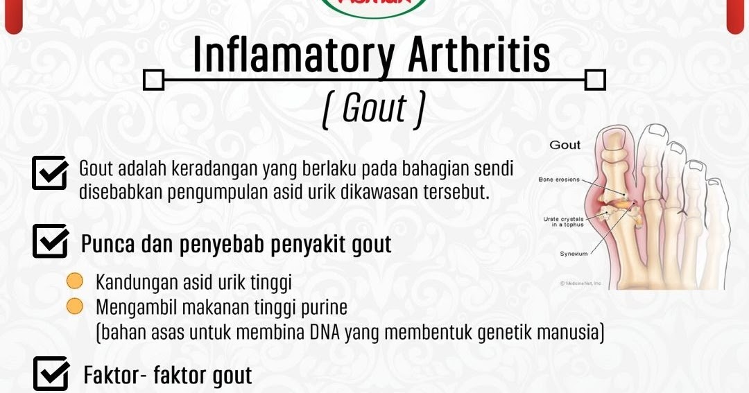 50 MAKANAN & MINUMAN ORANG GOUT PERLU PANTANG