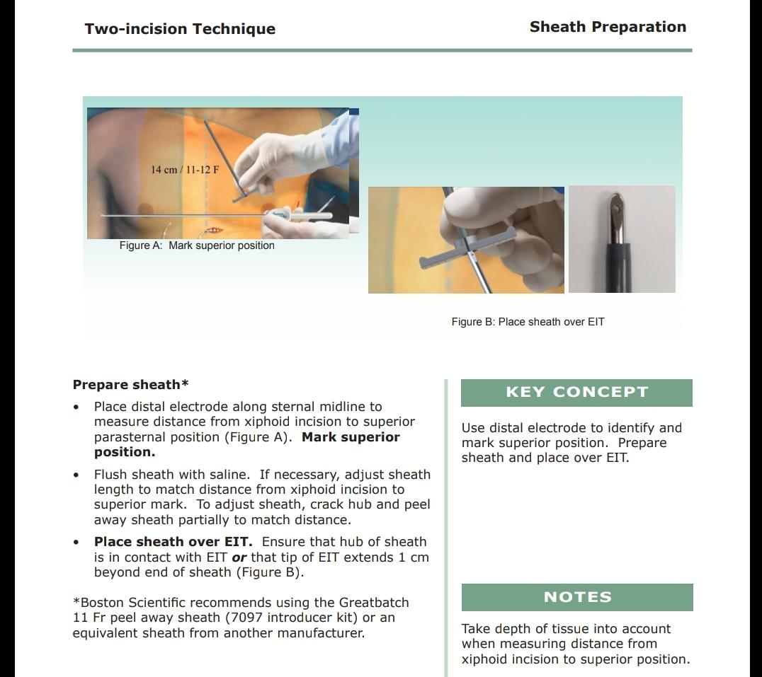 CVT Mohd Farid: Implant Management Of Subcutaneous ICD Boston Emblem SICD