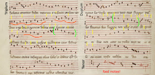 Music 101: A History of Notation (part 2)