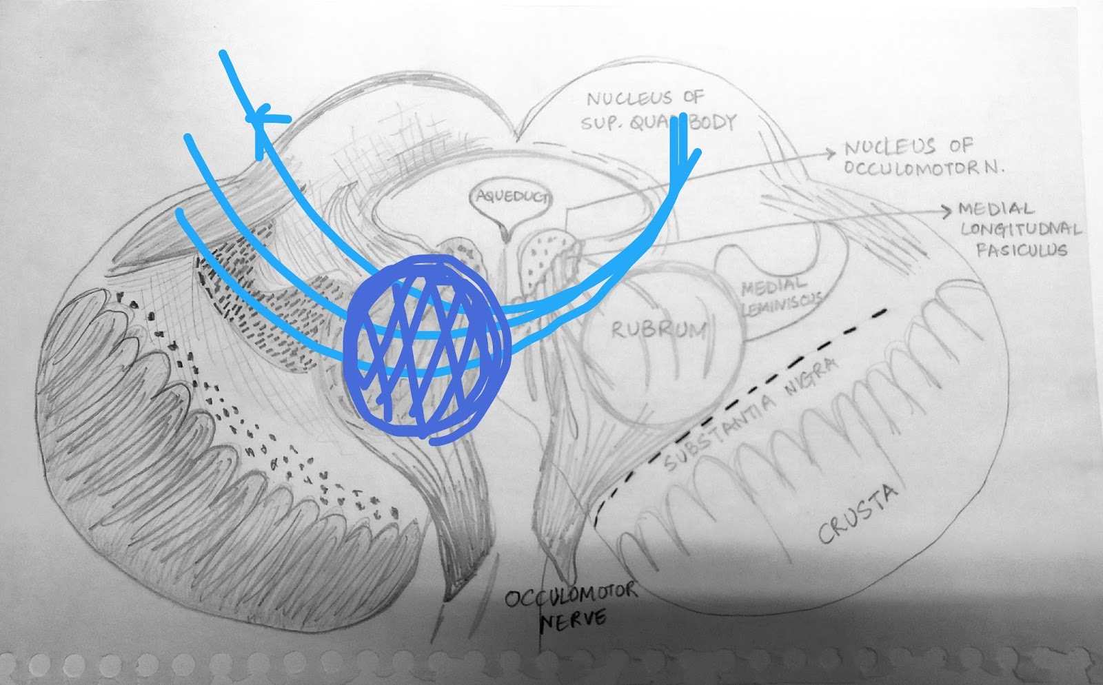 Medicowesome: Brainstem syndromes-Midbrain!