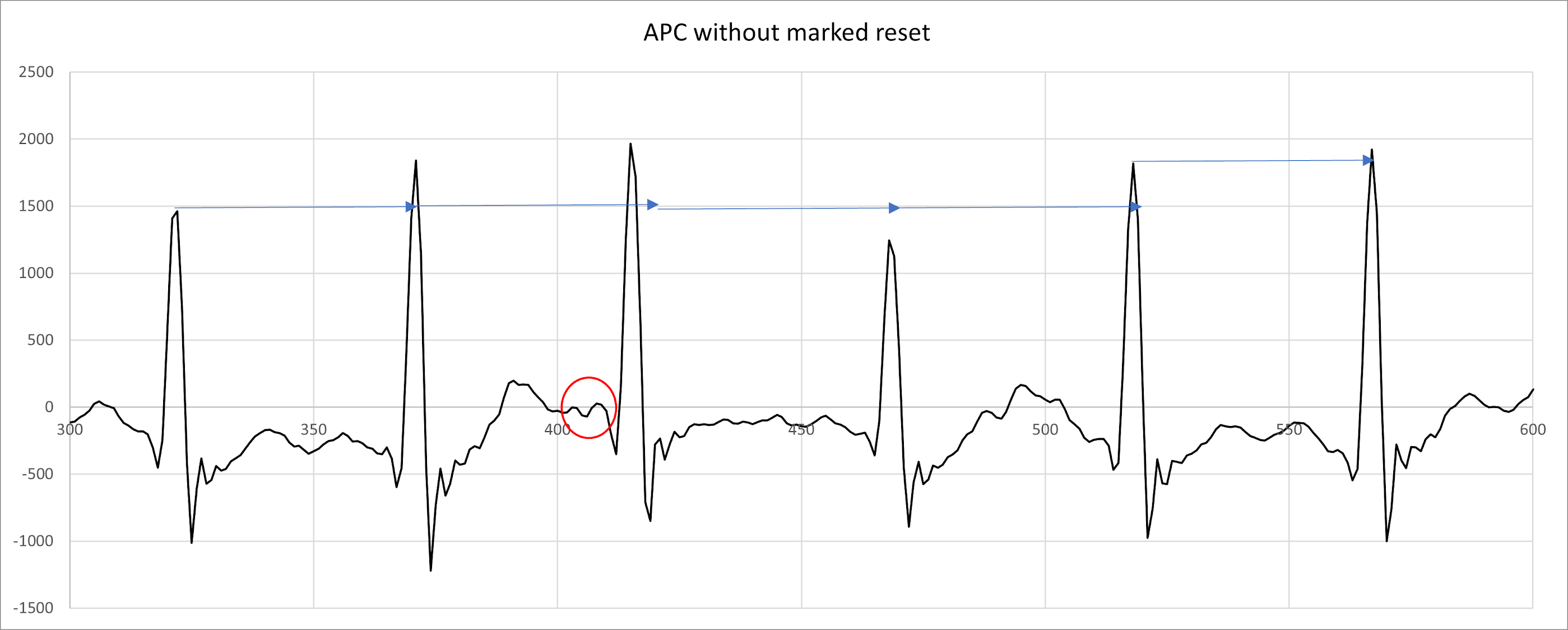Muscle Oxygen Training: ECG Arrythmia/Artifact visualization - some tips