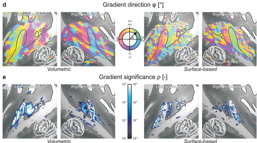 MVPA Meanderings: "Assessment of tonotopically organised subdivisions ...