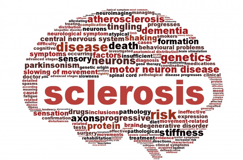 What Is Multiple Sclerosis Symptoms CancerOz What Is Multiple Sclerosis Symptoms CancerOz