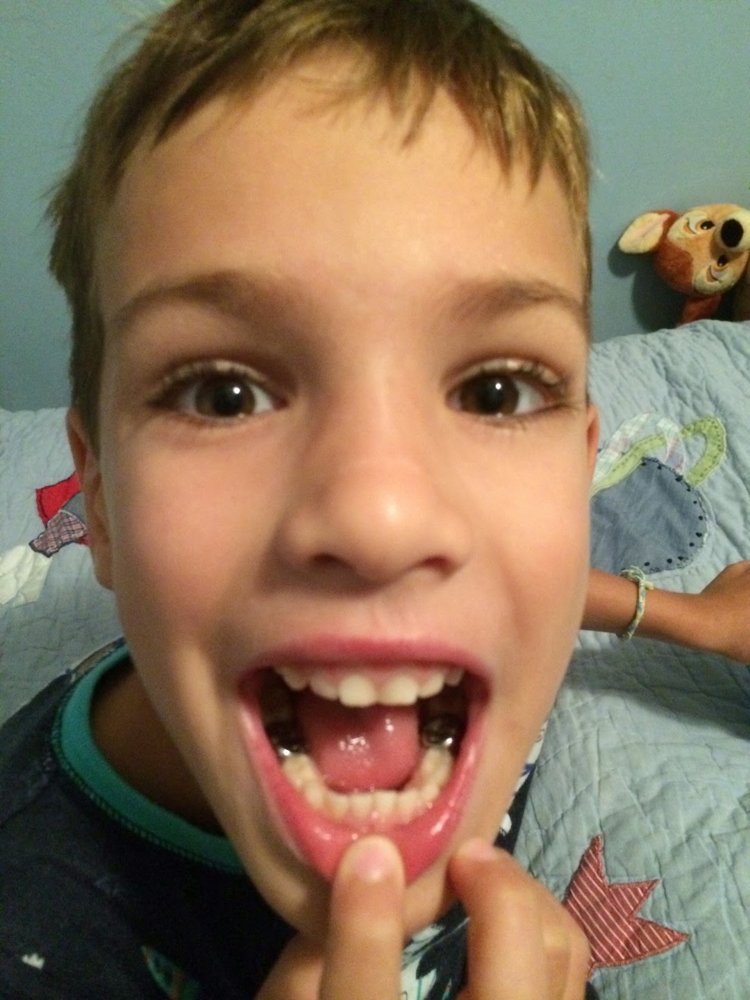 Adventures with twins: First Loose Tooth