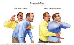 What should you do if someone is choking? - GoFreeBlogs