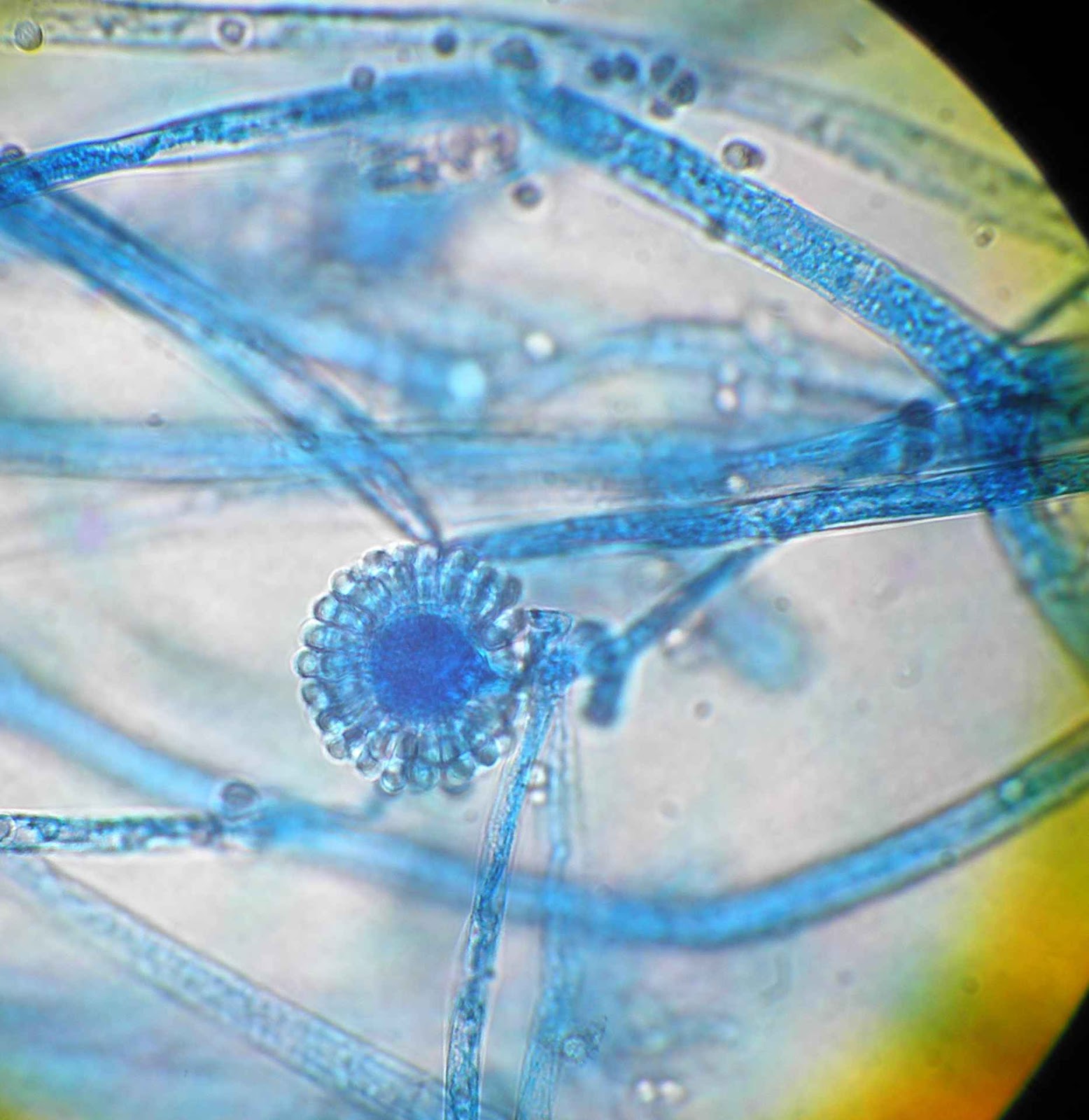 ATLAS MICOLOGIA: SYNCEPHALASTRUM RACEMOSUM