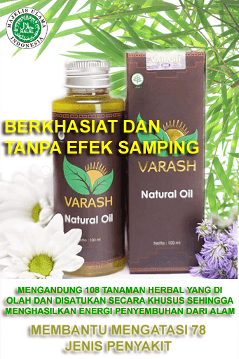 TERAPI KESELEO DENGAN VARASH - Minyak Varash Indonesia 0812-1737-190 (Jane)
