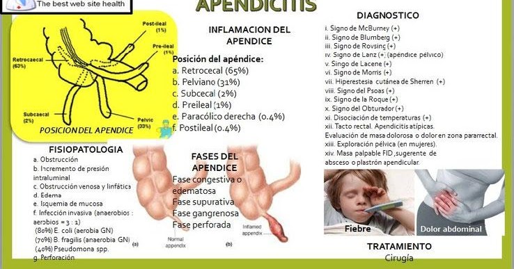 Apendicitis, clasificacion de la apendicitis