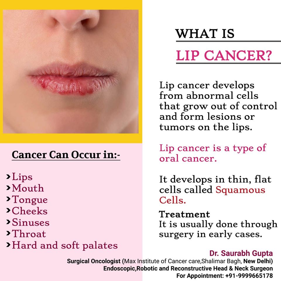 Dr Saurabh Gupta Oncologist November 2019