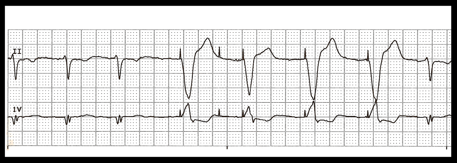 Float Nurse: Various Demand Pacing